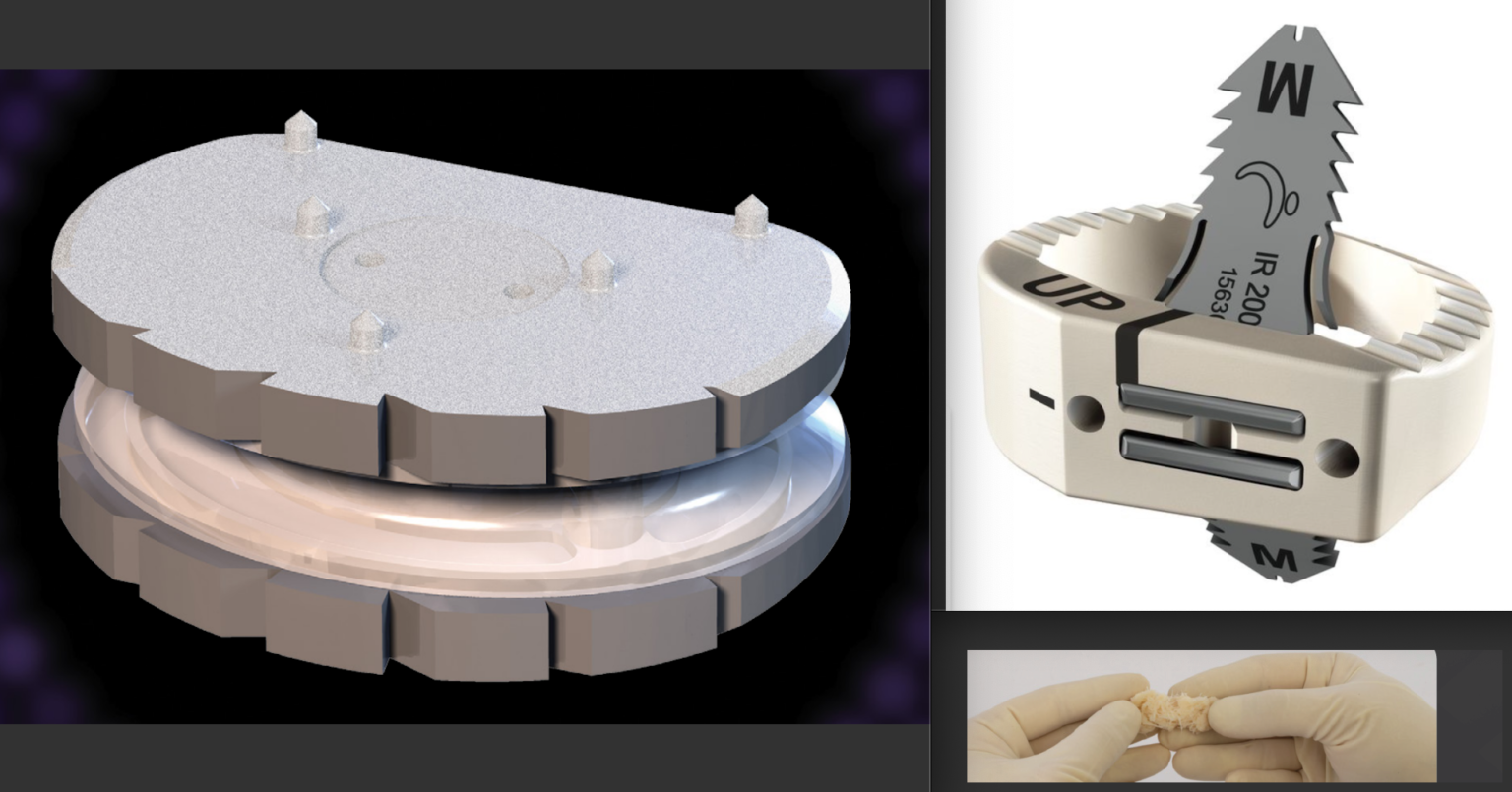 Artificial disc + cage anchor & fusion points for spinal biointegration ...